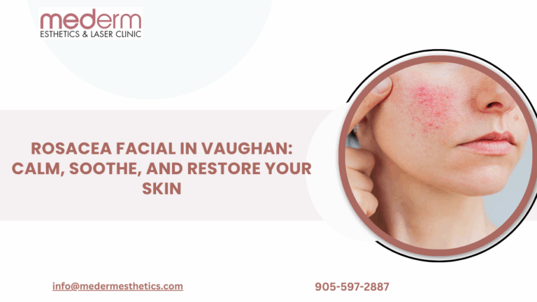 Rosacea Facial in Vaughan | Mederm Esthetic Laser Clinic